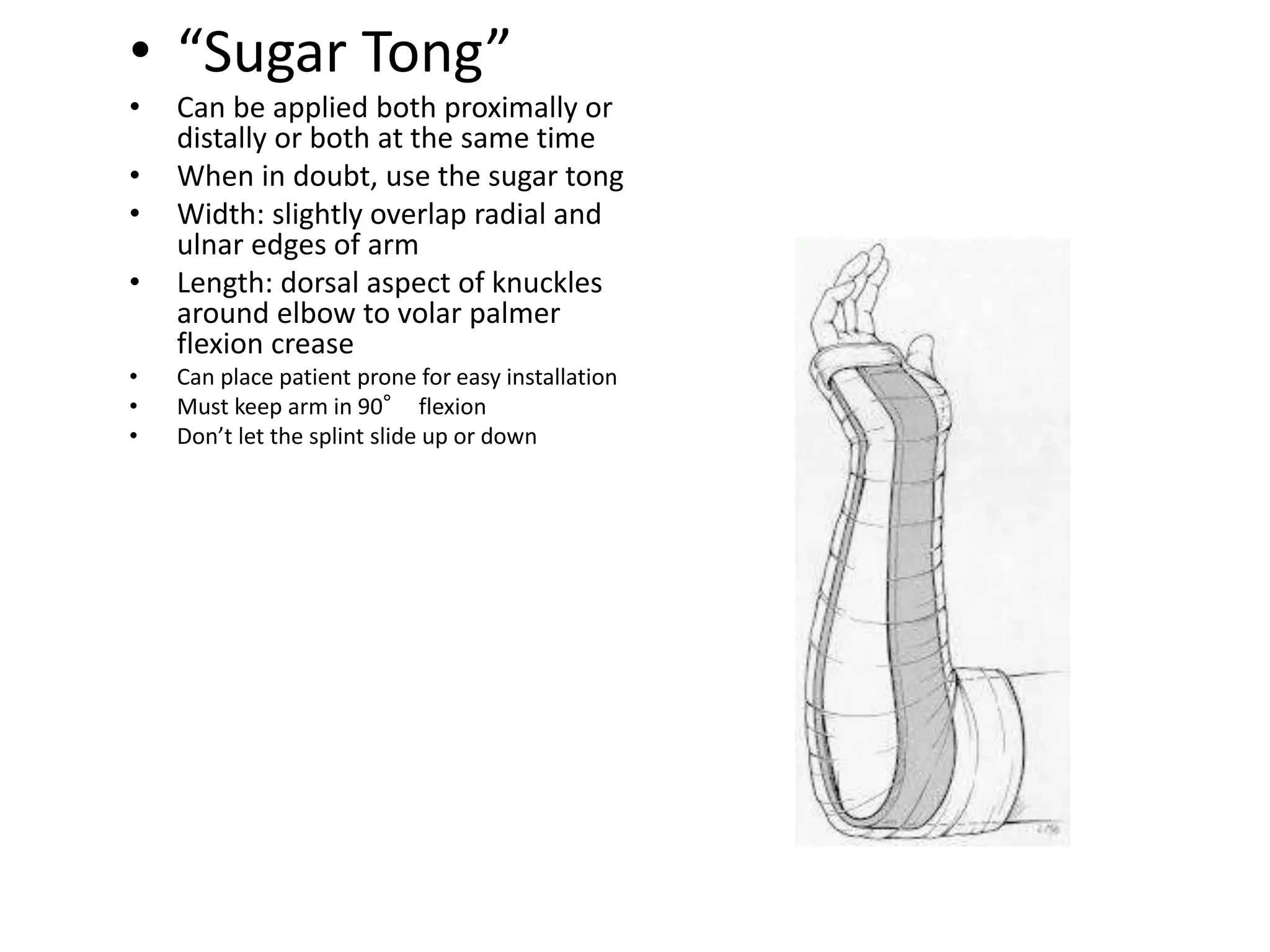 splint the children.ppt