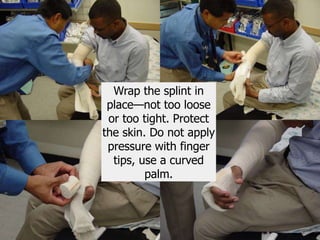 splint the children.ppt