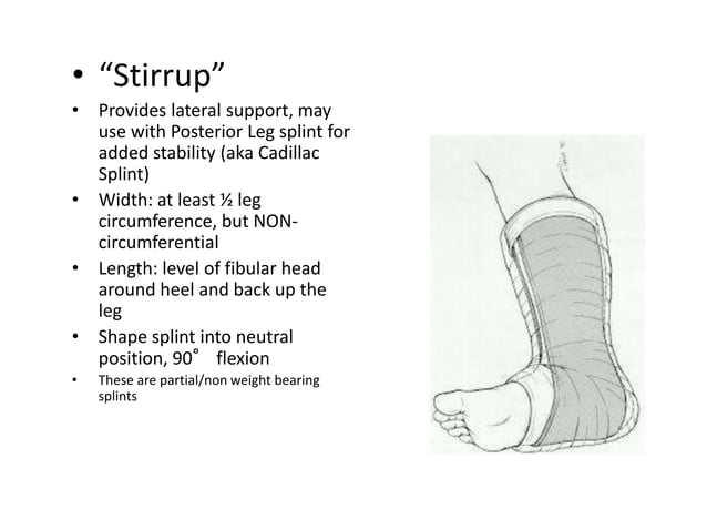 splint the children.ppt