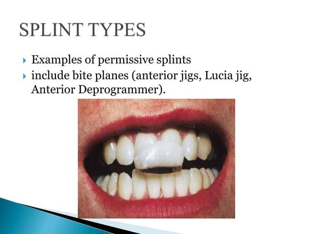 Splint therapy for tmj disc displacement | PPTX | Physical Therapy ...