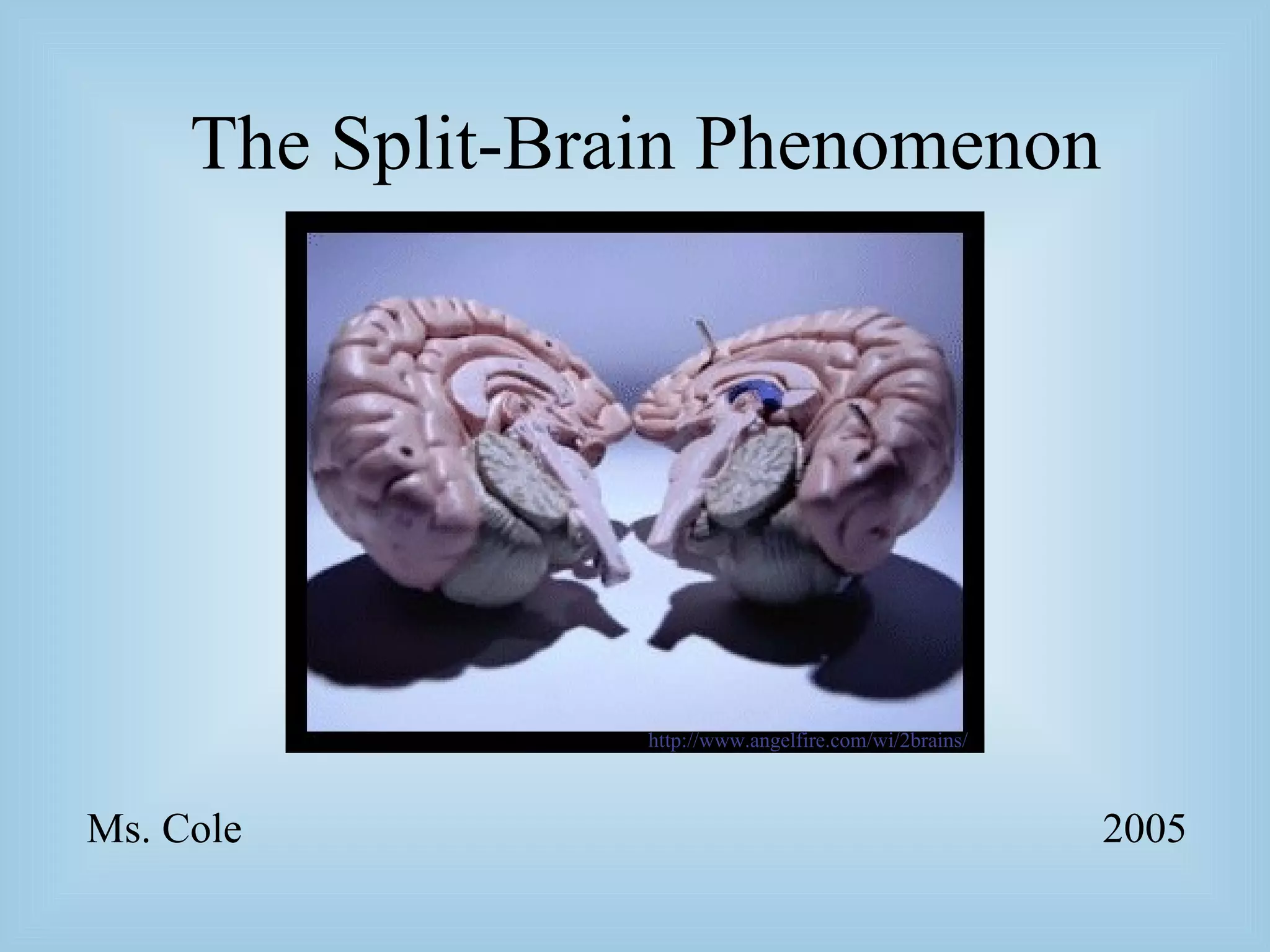 Split brain Phenomenon | PPT | Brain and Nervous System Disorders | Diseases and Conditions
