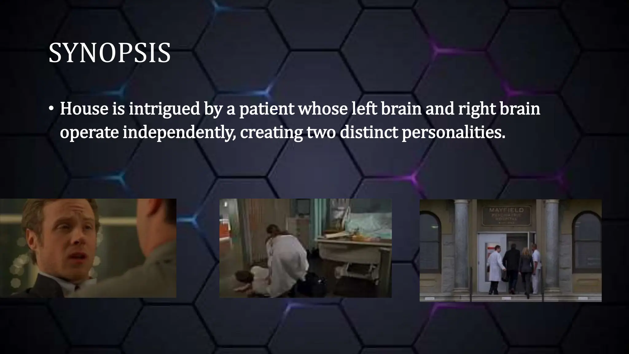 split brain Syndrome .pptx