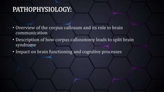 split brain Syndrome .pptx
