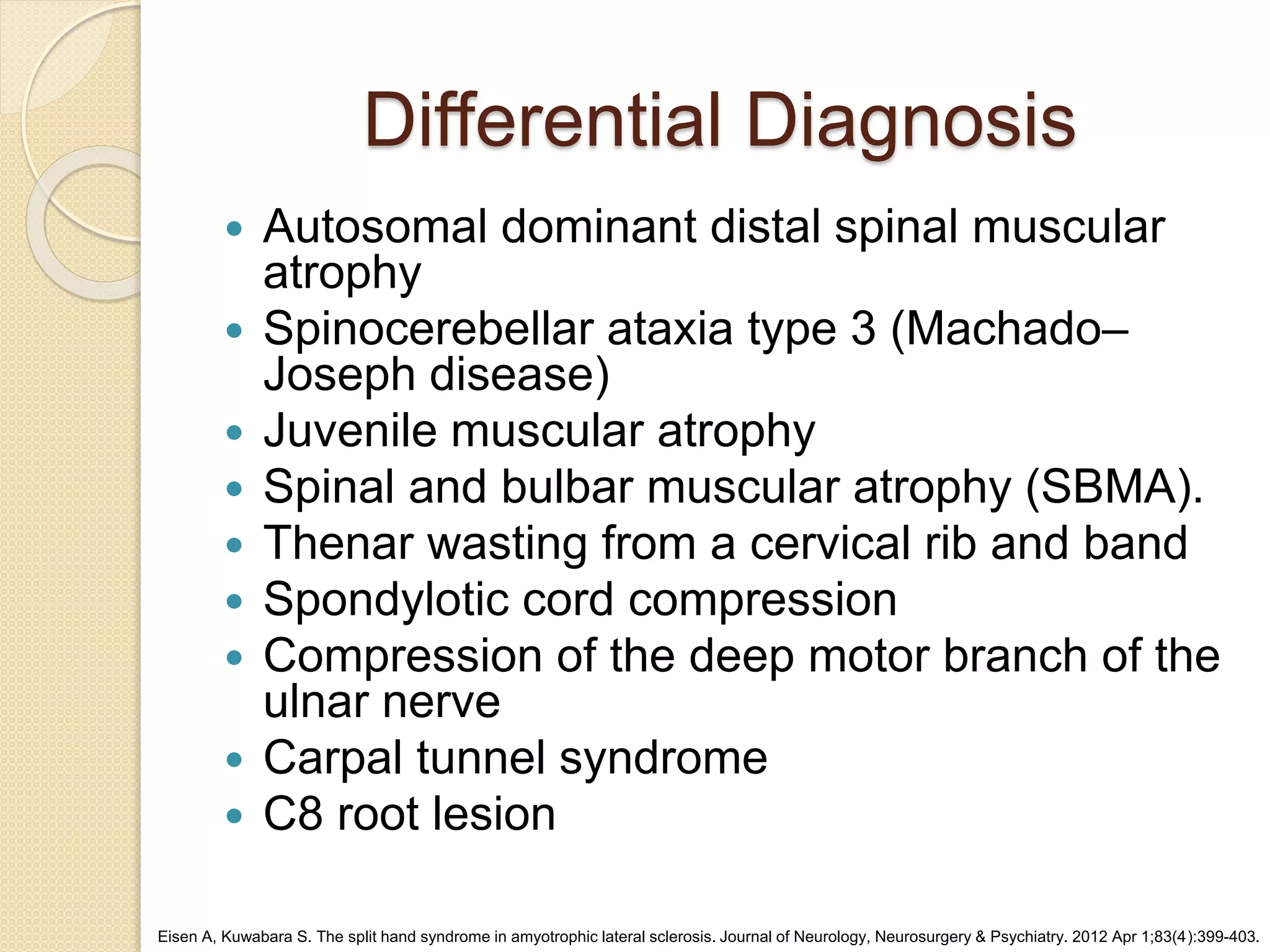 Split Hand Syndrome in Amyotrophic Lateral Sclerosis | PPTX