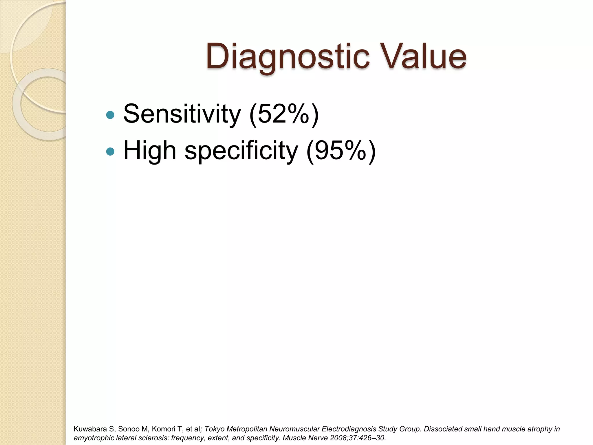 Split Hand Syndrome in Amyotrophic Lateral Sclerosis | PPTX