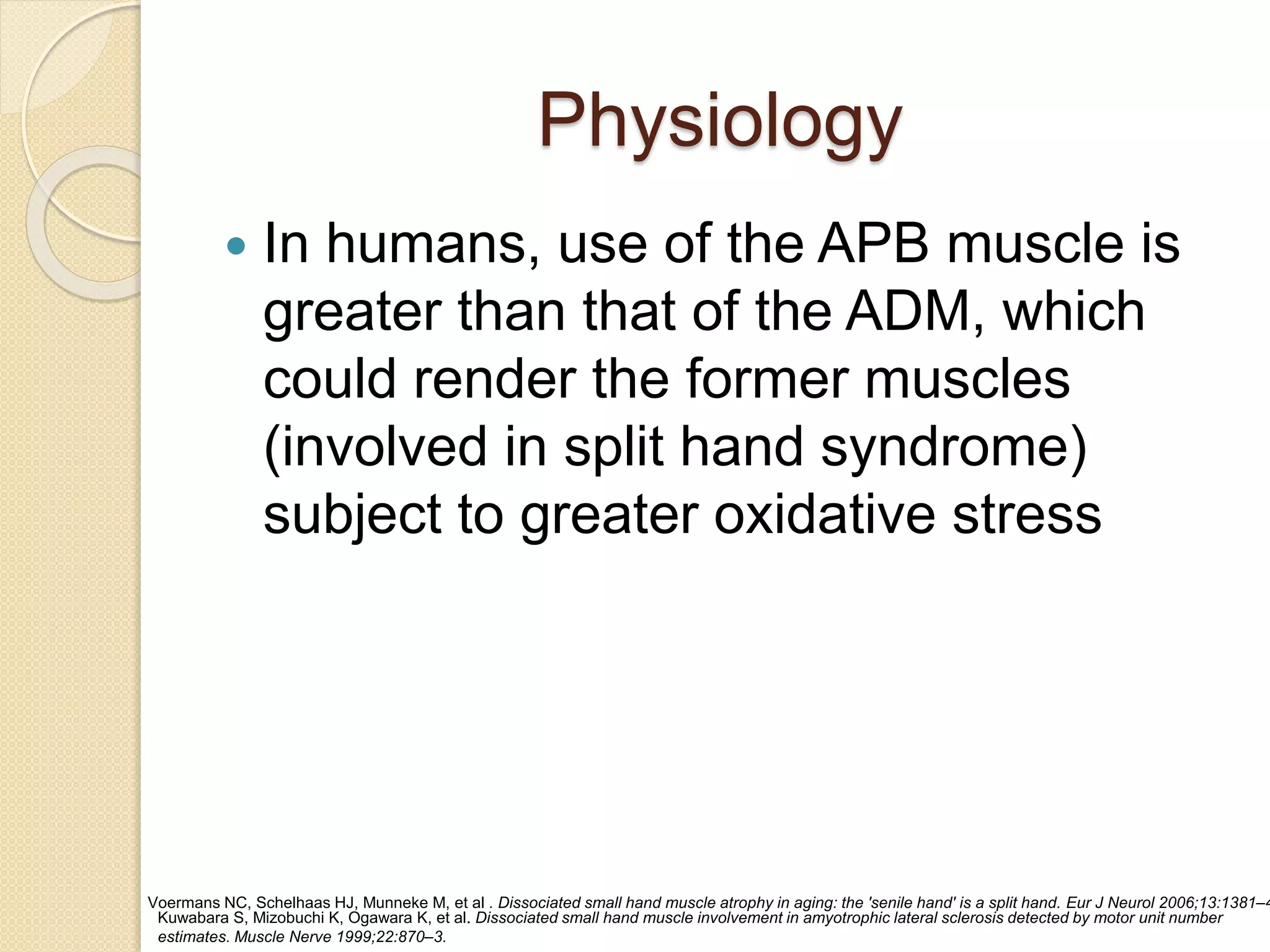 Split Hand Syndrome in Amyotrophic Lateral Sclerosis | PPTX