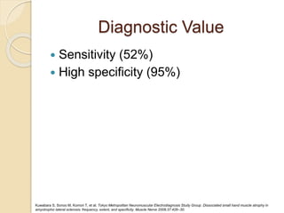 Split Hand Syndrome in Amyotrophic Lateral Sclerosis | PPTX