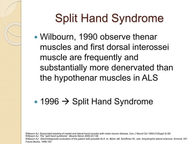 Split Hand Syndrome in Amyotrophic Lateral Sclerosis