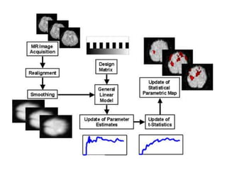 Spm12를 이용한 fmri analysis | PPT