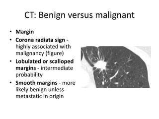 Solitary pulmonary nodule vp.pptx