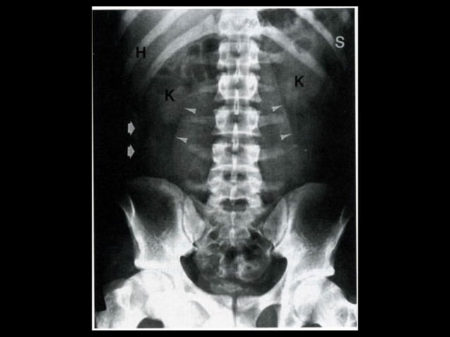 Spom Imaging | PPT | Medical Tests | Medical Health