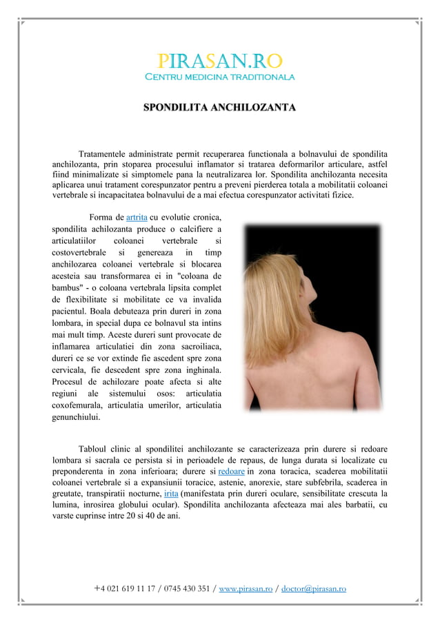 Spondilita anchilozanta | PDF
