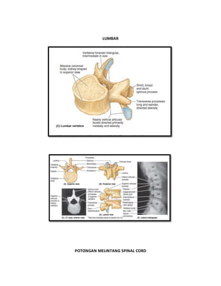 Spondilitis tb | DOCX