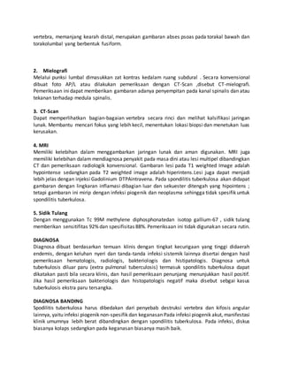 Spondilitis tb | DOCX