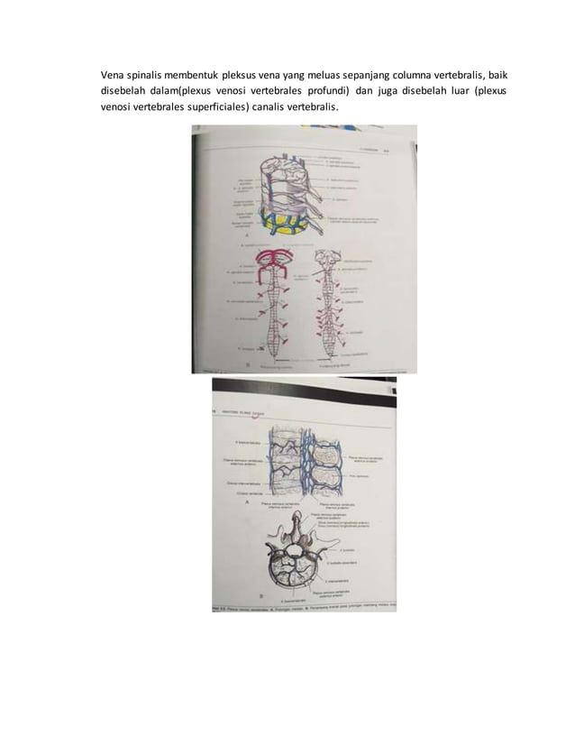 Spondilitis tb | PDF