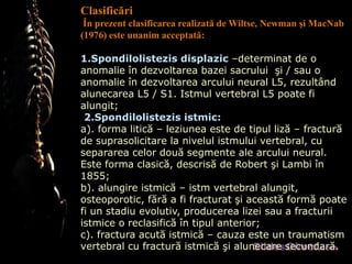 Spondiloliza 29 06 14 | PPTX