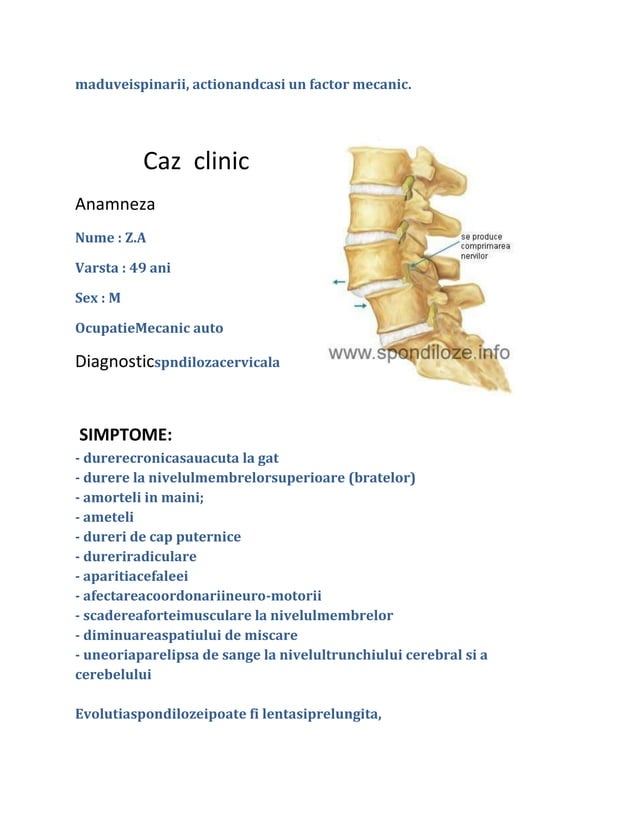 Spondiloza kinetoterapie | PDF