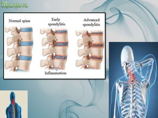 Spondin ppt | PPTX