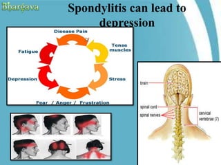 Spondin ppt | PPTX