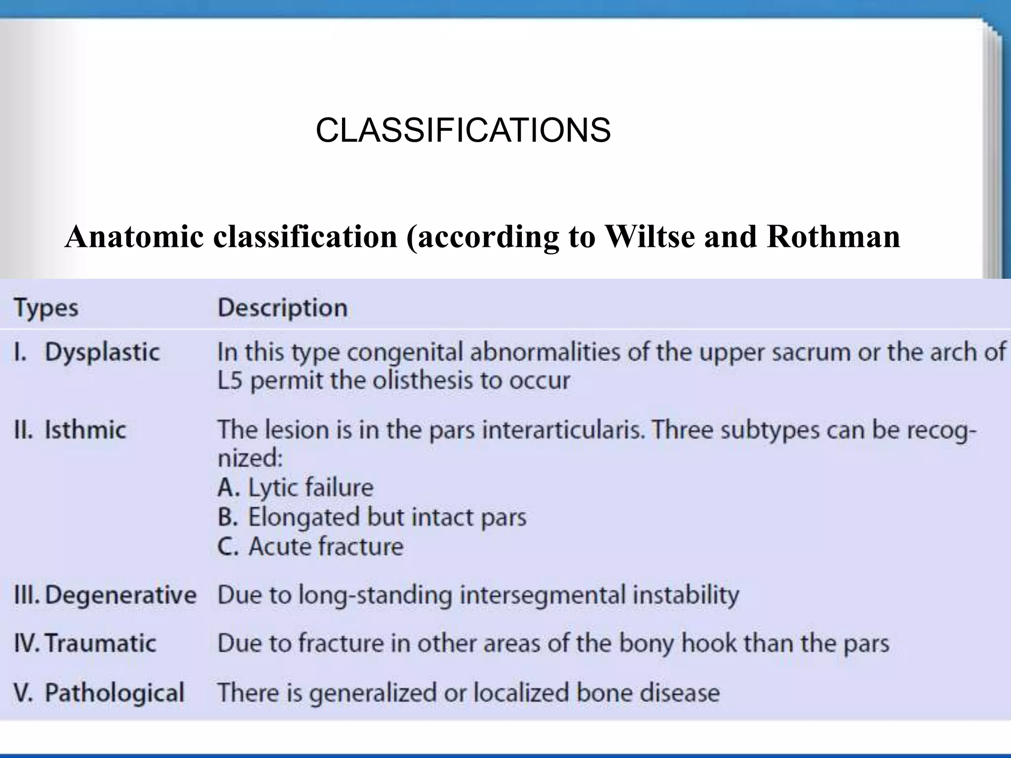 Spondylolisthesis review | PPTX
