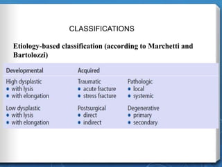 Spondylolisthesis review | PPTX