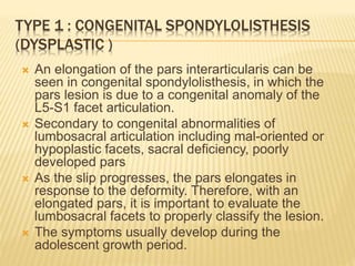 Spondylisthesis by dr venkata rama krishnaiah vapms cop | PPTX