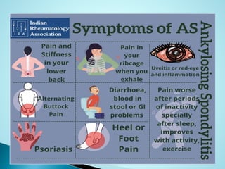 Ankylosing Spondylitis PPT pharmacotherapeutics II | PPTX
