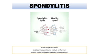 Spondylitis: Diagnosis and Treatment as per Guidelines | PPT