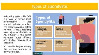 Spondylitis: Diagnosis and Treatment as per Guidelines | PPT