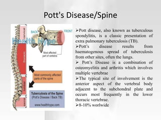 Spondylitis and It's Pharmacotherapy | PPTX