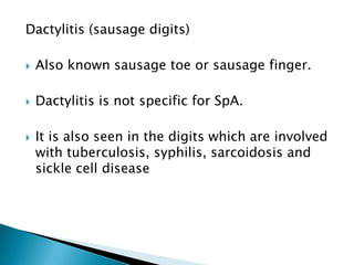 Spondyloarthropathy | PPTX
