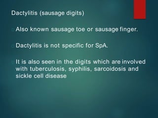spondyloarthropathy.pptx