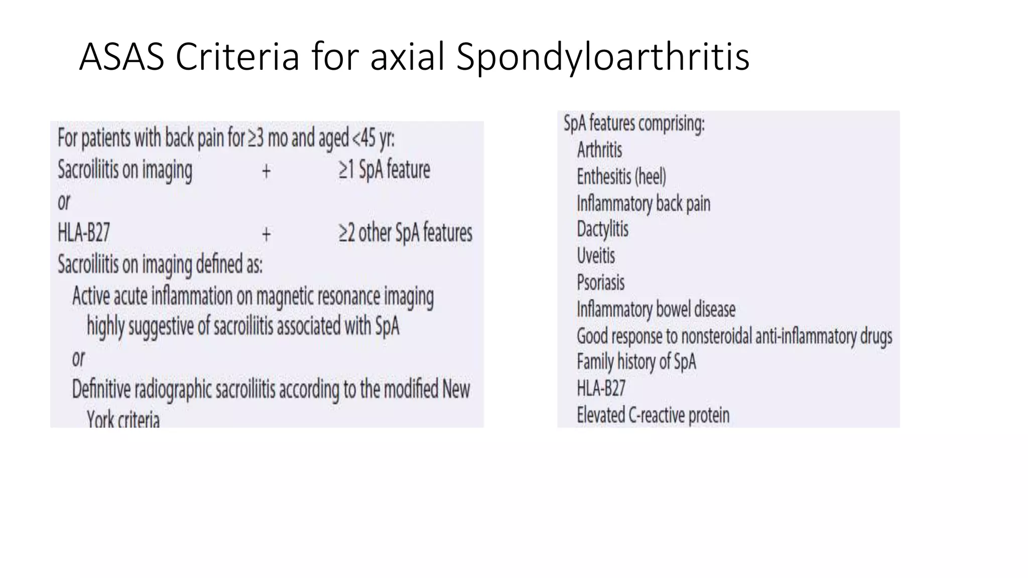 Spondyloarthropathy:An update | PPTX