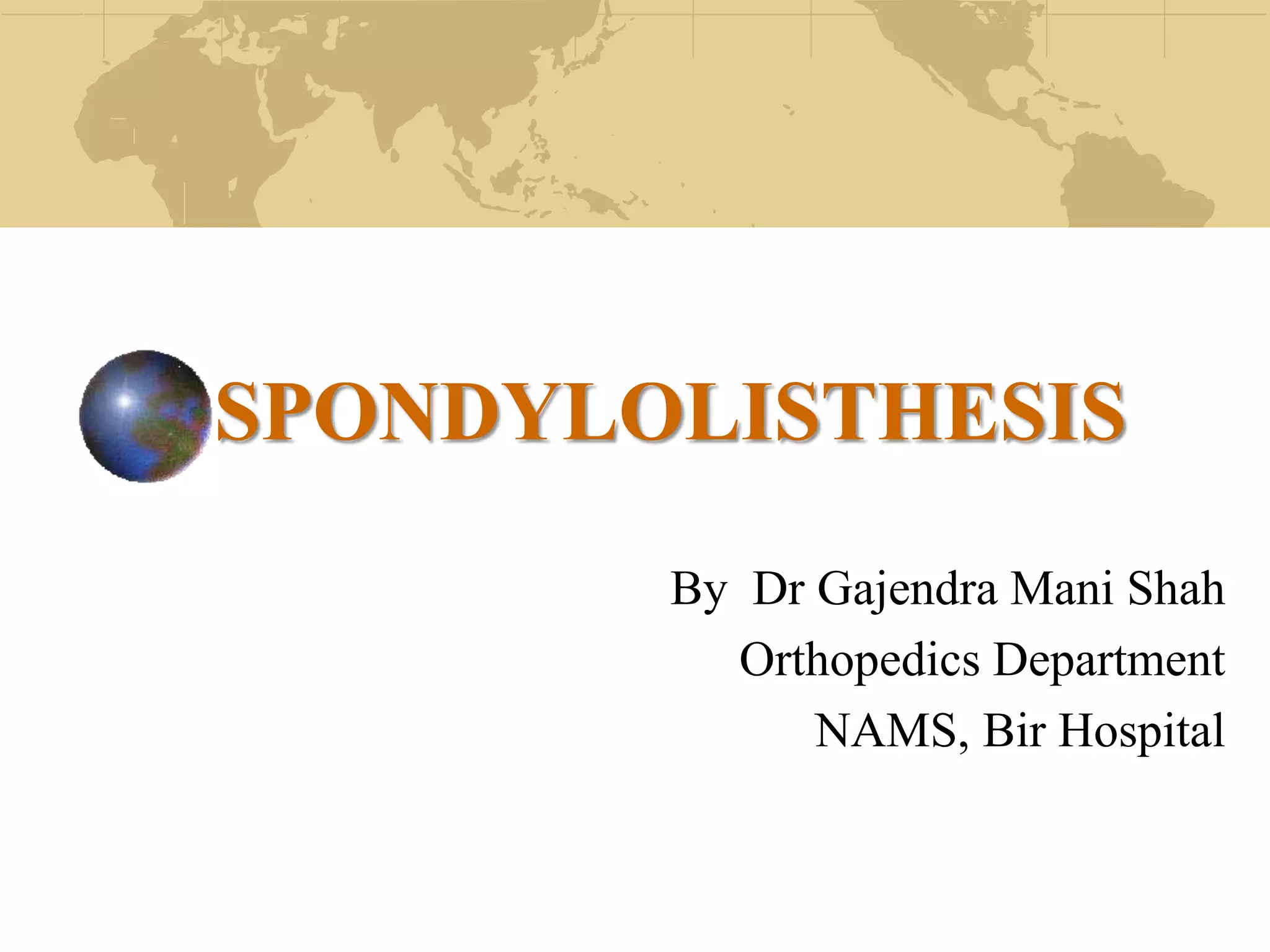 Spondylolisthesis | PPTX