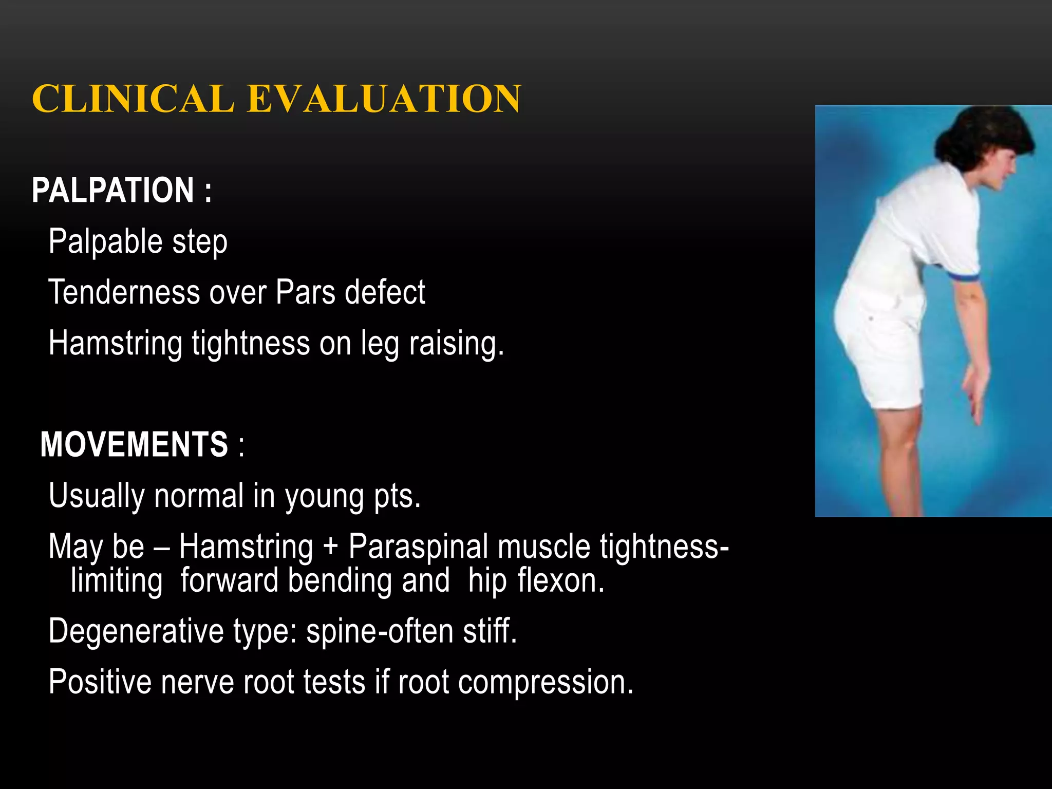 SPONDYLOLISTHESIS: DIAGNOSIS, CLASSIFICATION, EVALUATION AND MANAGEMENT ...