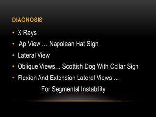 Spondylolisthesis | PPT