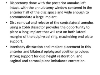 Spondylolisthesis | PPTX