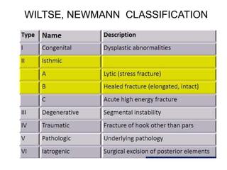 Spondylolisthesis | PPTX