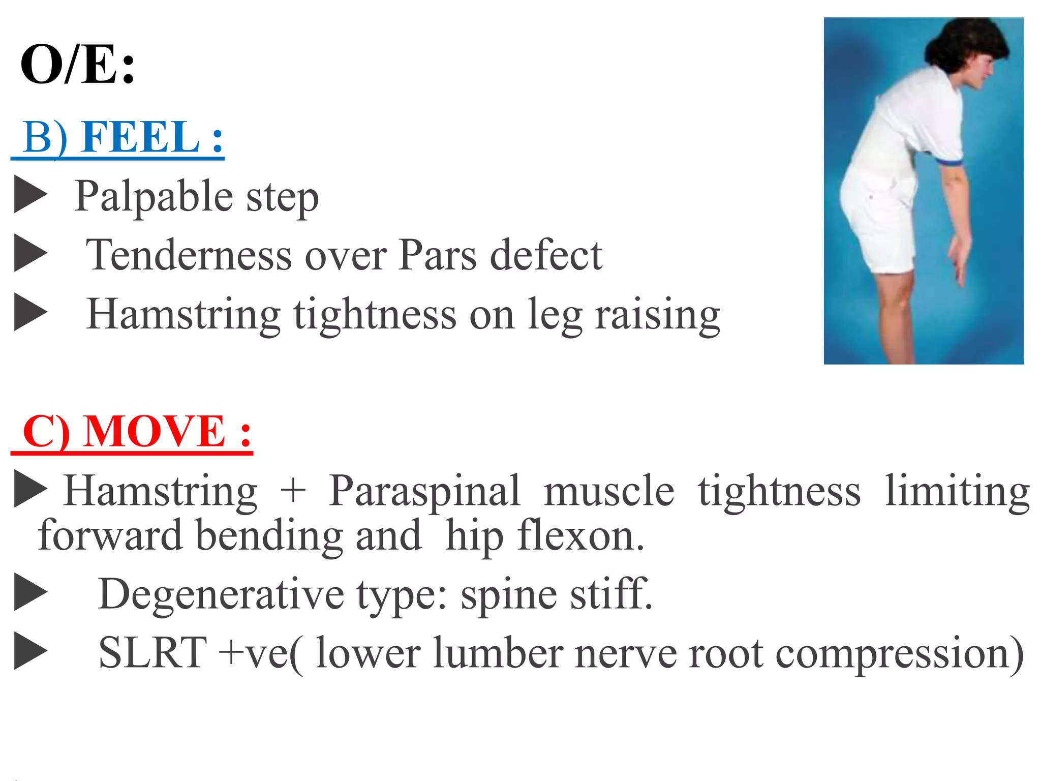 SPONDYLOLISTHESIS.ppt