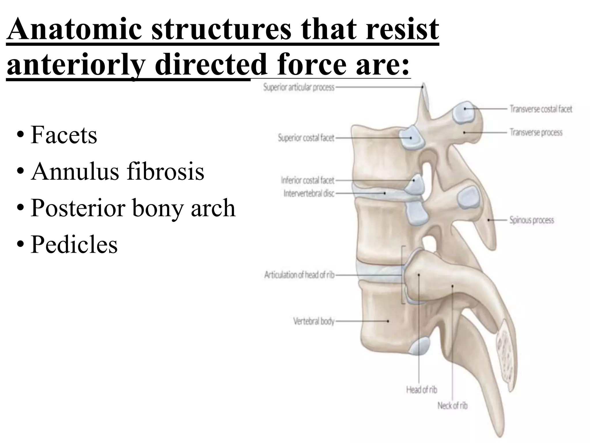 SPONDYLOLISTHESIS.ppt