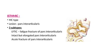 SPONDYLOLISTHESIS DRD.pptx