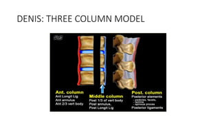 SPONDYLOLISTHESIS DRD.pptx