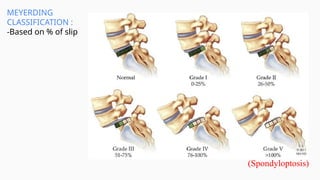 Spondylolisthesis, Lumbar Spondylosis.pptx