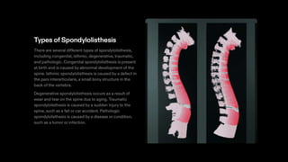 Spondylolisthesis (we are spine).pptx