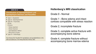 Spondylolysis.pptx by Dr Adarsha HM, Orthopaedic Spine Surgeon | PPTX