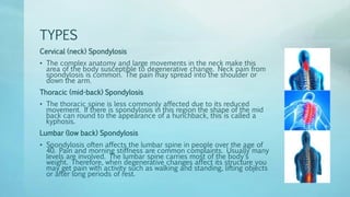 Spondylosis | PPTX