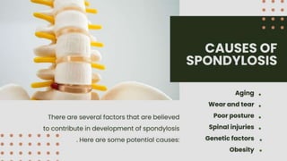 Spondylosis Type, Causes and Treatment.pptx