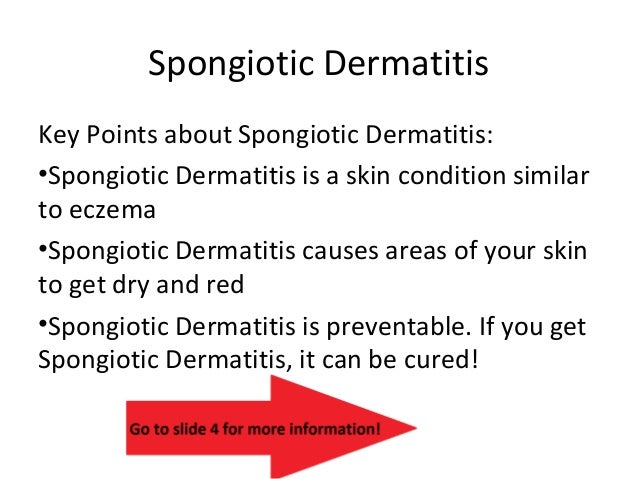 Spongiotic Dermatitis