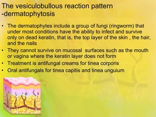 Spongiotic dermatitis tinea | PPT