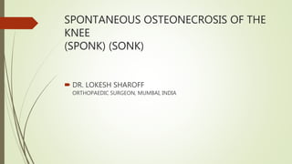 Sponk ppt | PPTX